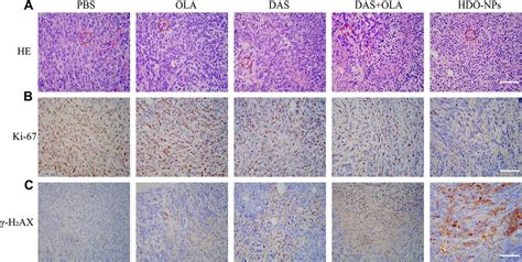 He Staining Ki 67 Staining And γ H2ax Staining Of Tumors After
