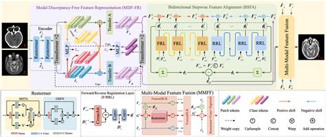 入选aaai 2025！多模态医学图像融合新突破！bsafusion A Bidirectional Stepwise Feature