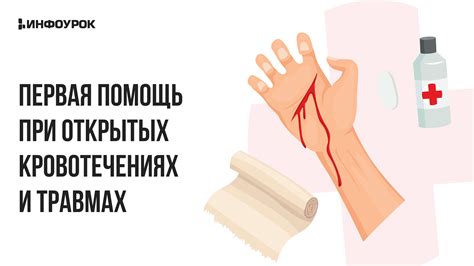 Видеолекция Первая помощь при открытых кровотечениях и травмах