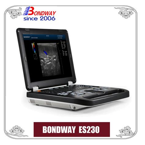 Full Digital Portable Color Doppler Ultrasound System Sonography D Ultrasound D Ultrasonic
