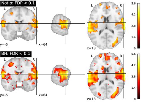 Detection Rate Comparison Between Learned Template And The Bh Procedure Download Scientific