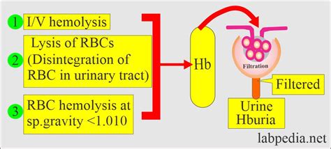 Hemoglobinuria Vs Myoglobinuria