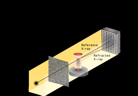 Generic Setup For X Ray Speckle Tracking Download Scientific Diagram