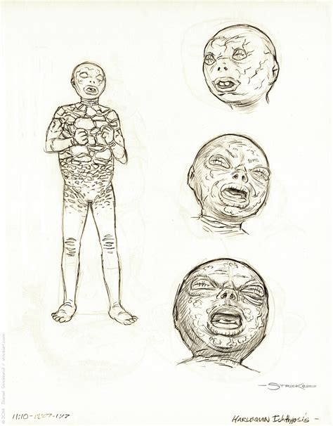 Harlequin Ichthyosis By Strickart On Deviantart