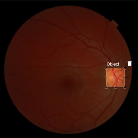 Optic Disc Annotations In Voc Format Kaggle