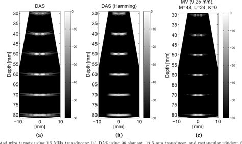 Figure 3 From Benefits Of Minimum Variance Beamforming In Medical