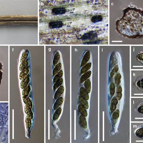 Alternaria Sect Ulocladium Conidia And Conidiophores A B A