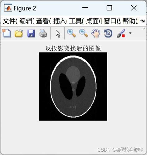 【图像重建】使用fdk的三维谢普洛根幻影重建（matlab代码实现） 知乎