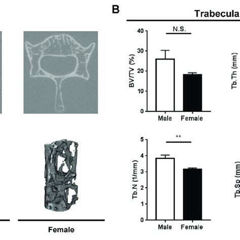 Trabecular Microarchitecture Of Vertebrae From Male N 5 And Female Download Scientific