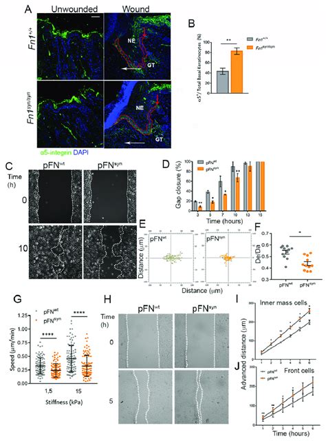 Re Epithelialization And Characterization Of Keratinocyte Migration On