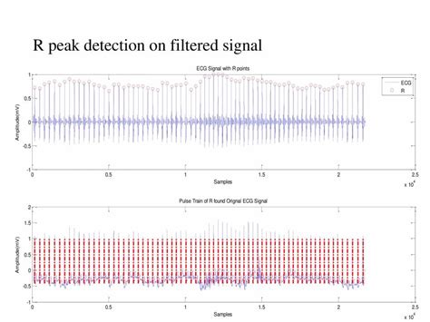 Optimal Ecg Data Compression For An E Health Transmission System Powerpoint Slides Learnpick