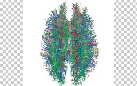 White Matter Brain Human Connectome Project Central Nervous System Png