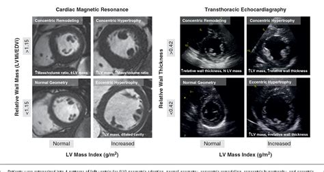 Figure 1 From Sex Dimorphism In The Myocardial Response To Aortic