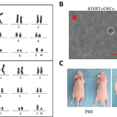 The Chromosomal Karyotyping And Tumorigenicity Assay Of Htert Coecs Download Scientific