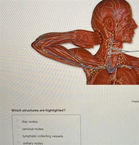 Answered Which Structures Are Highlighted C Iliac Nodes Cervical Kunduz