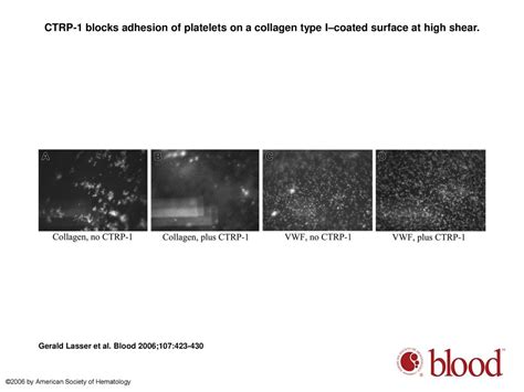 C1qtnfrelated Protein 1 Ctrp 1 A Vascular Wall Protein That