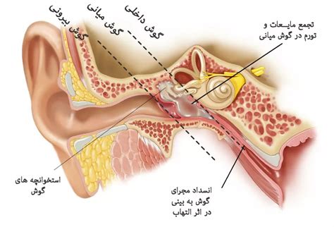 علت برآمدگی و غدد پشت گوش چیست؟ نحوه‌ی تشخیص و روش‌های درمانی مختلف