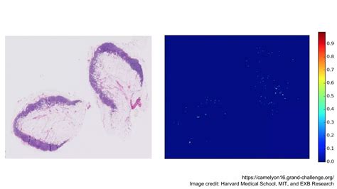 A Survey Of Deep Learning Approaches To Medical Applications Pdf