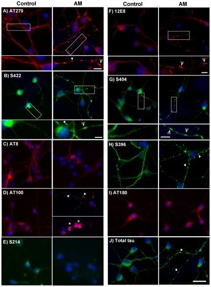 Phospho Tau Ser202 Thr205 Antibody Biotin Monoclonal At8
