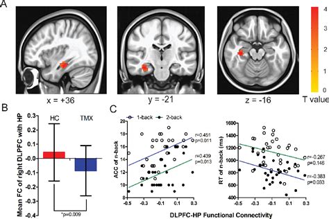 Figure 1 From The Working Memory And Dorsolateral Prefrontal Hippocampal Functional Connectivity
