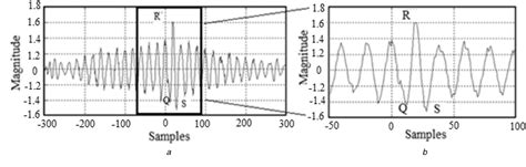 Figure 5 From Real Time Cross Correlation Based Technique For Detection