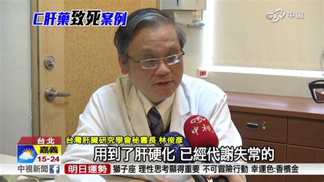 C肝口服新藥死亡首例 嚴重肝硬化患者不治│中視新聞 20170109 Youtube