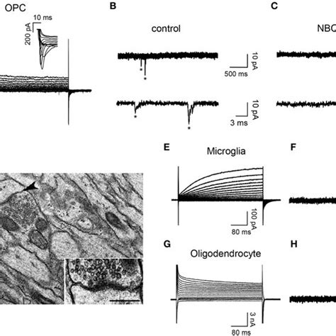 Lpc Induced Demyelination Model A Lysolecithin Lpc Was Injected In