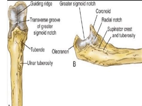 Olecranon Fracture Anatomy Clinical Picture Pptx