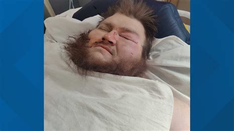 Tow Truck Driver Injured Victim In Hit And Run On Oregon I 84