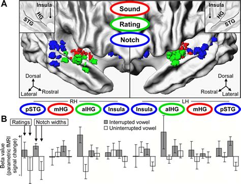 Activity Patterns In Individual Cortical Regions Sensitive To Sound Download Scientific
