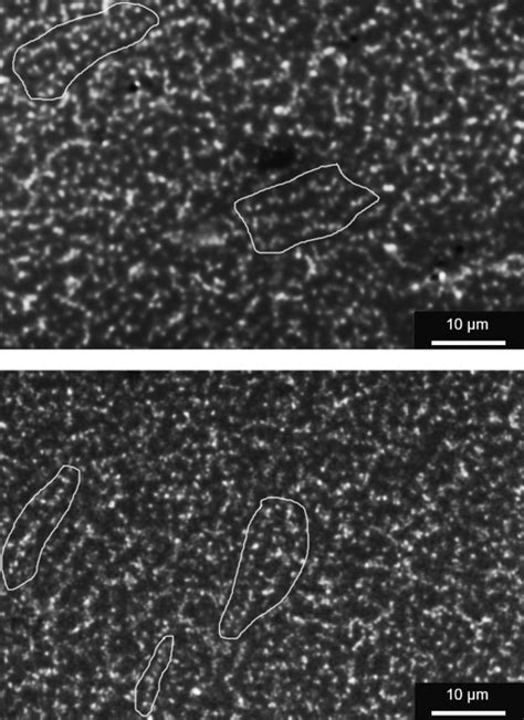 Bitter Decoration Patterns In Overdoped Bani 0 16 Upper Image H A