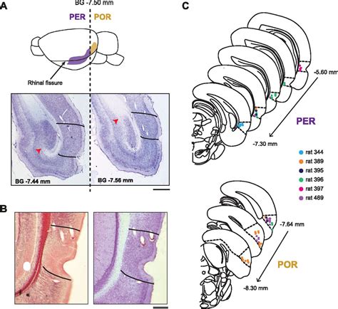 Rhinal Cortex Sectioned View