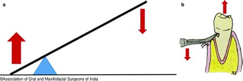 14 A The Small Force And Large Movement Transformed To Small Movement Download Scientific