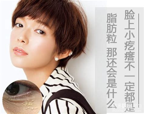 眼睛周圍長出這些煩人的脂肪粒，到底該咋辦？ 每日頭條