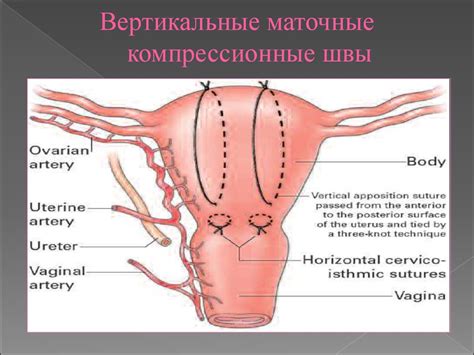 Акушерские кровотечения - презентация онлайн