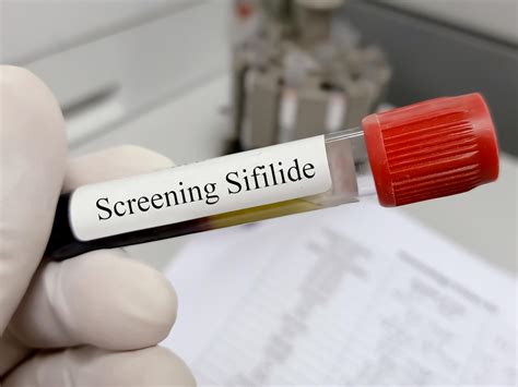 Vdrl E Tpha Test Interpretare Il Risultato Dellesame Per La Sifilide