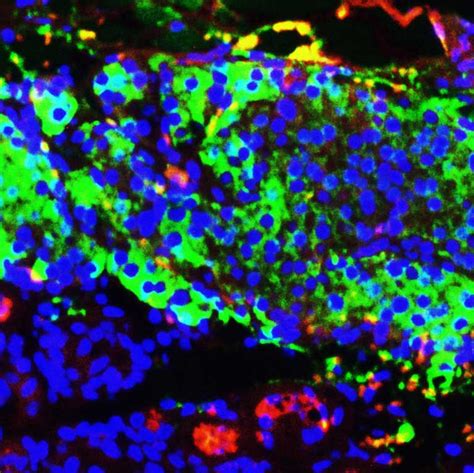 Salk Scientists Find Secret Sauce” For Personalized Functional