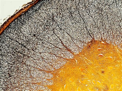 The Brains Glial Cells Might Be As Important As Neurons