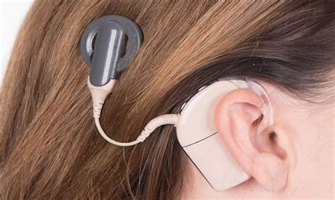 Implantable Microphone Could Lead To Fully Internal Cochlear Implants Suggests Research