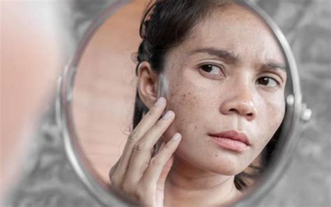 Pilih Mana Untuk Kulit Kusam Pico Triple White Atau Pico Ipl