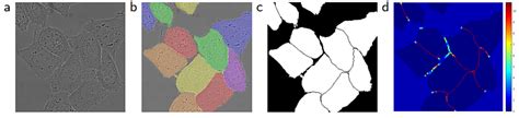 Deep Learning For Image Segmentation U Net Architecture Comet