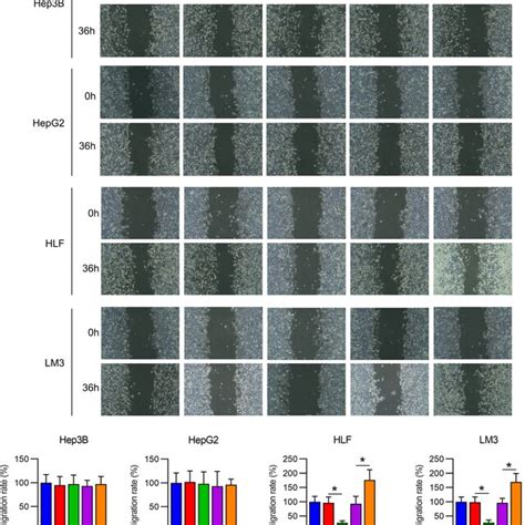 Invasion Of Hepatocellular Carcinoma Hcc Cell Lines With Dysregulated