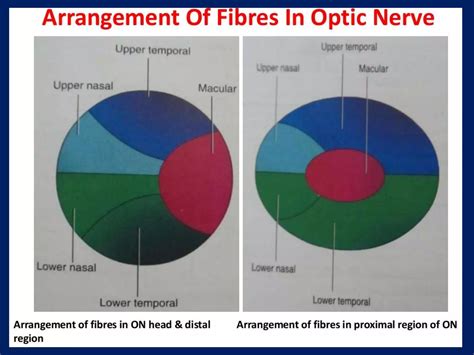 Anatomy Of Optic Nerve Pptx