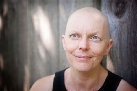 Coping With Hair Loss During Chemotherapy