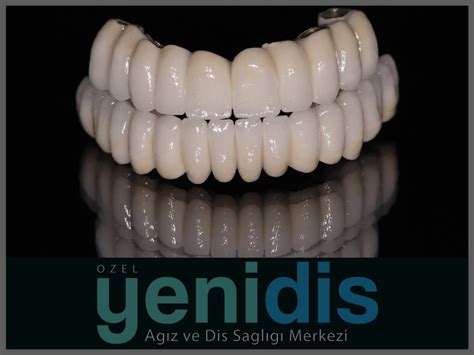 Smile Gallery
