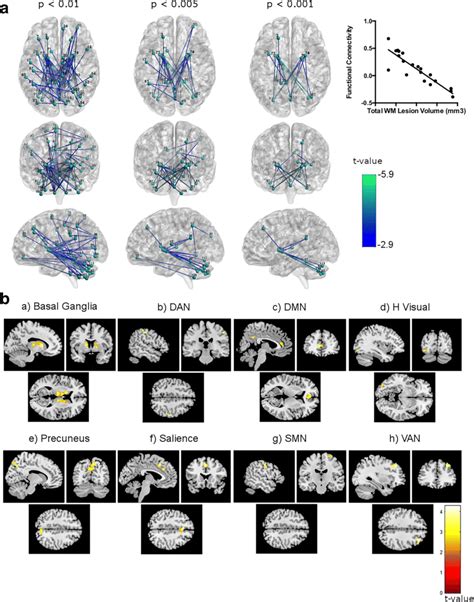 Reduced Functional Connectivity Fc In Relapsing Remitting Multiple Download Scientific