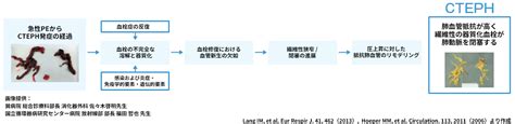 Ctephの概要 Msd Connect