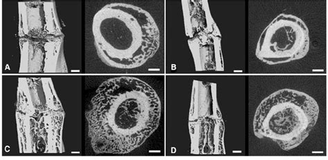 Ad The Figures Show Representative Axial Slices And Threedimensional