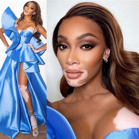 Winnie Harlow Sexy At Oscars Party 2021 17 Photos Videos The