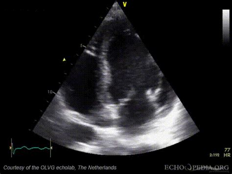 Filevegetatiemv01 Echopedia